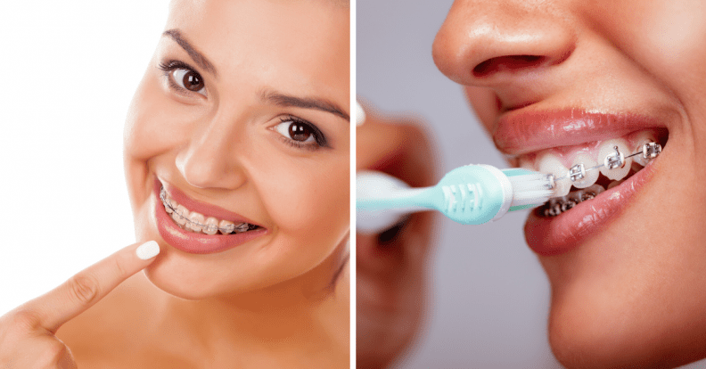 Ortodoncia - Clínica Dental en Ciudad Real - Dr Viso